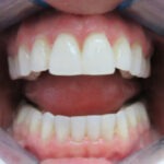 Top Dentist Fairfax VA | Reston VA | Optimal Dental Center